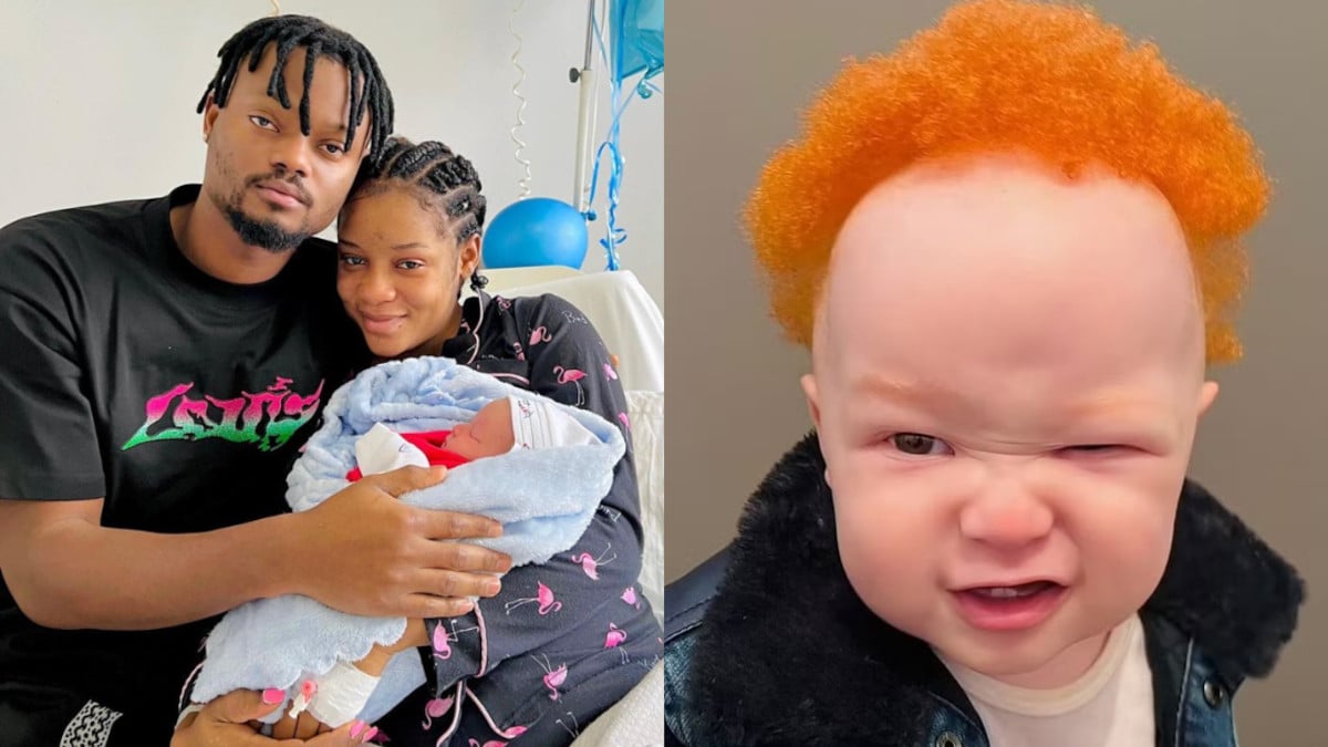 Su bebé nació albino: tomó drástica decisión para ayudarlo | Bioguia