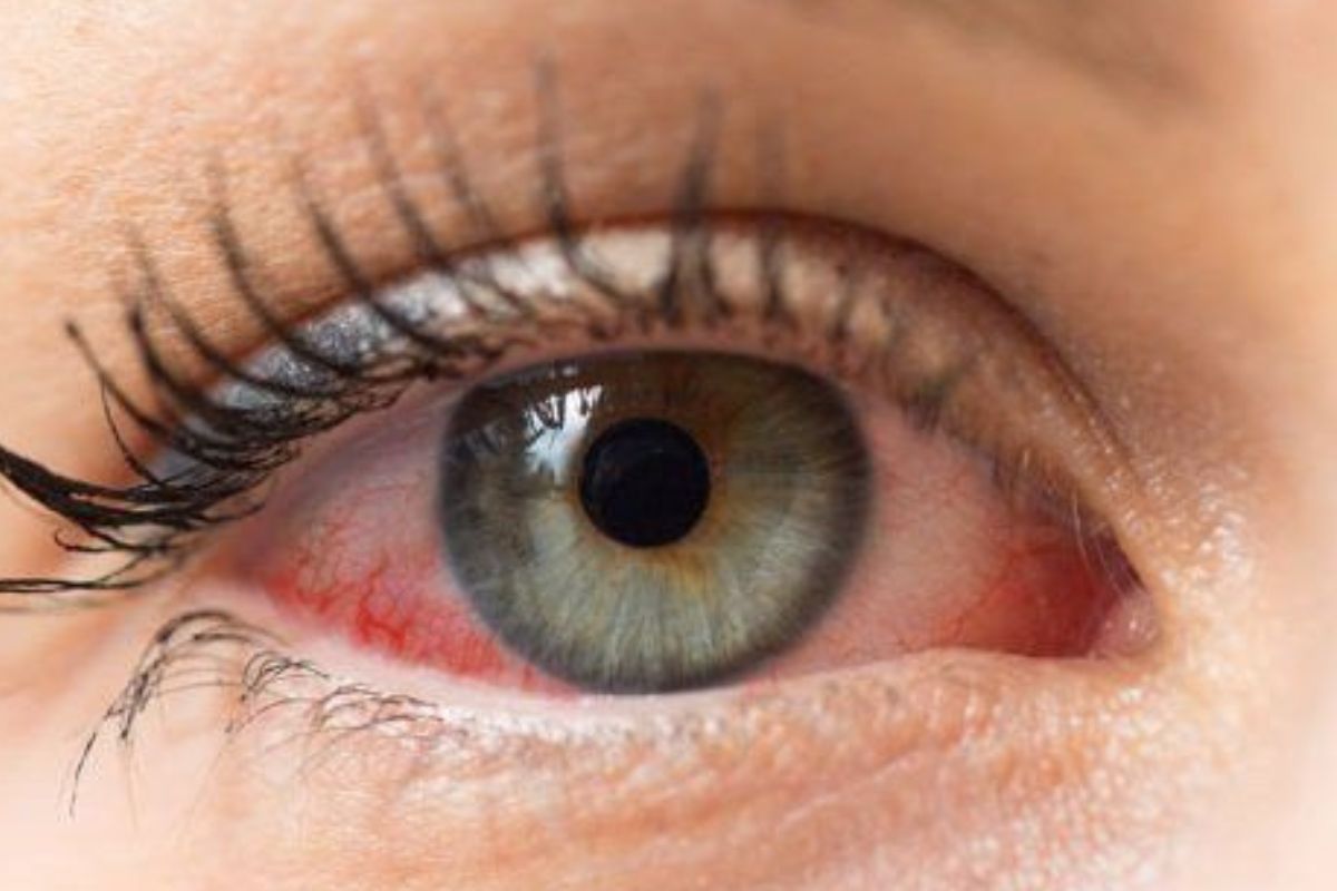 El síntoma del cáncer de ojos que solemos pasar por alto | Bioguia